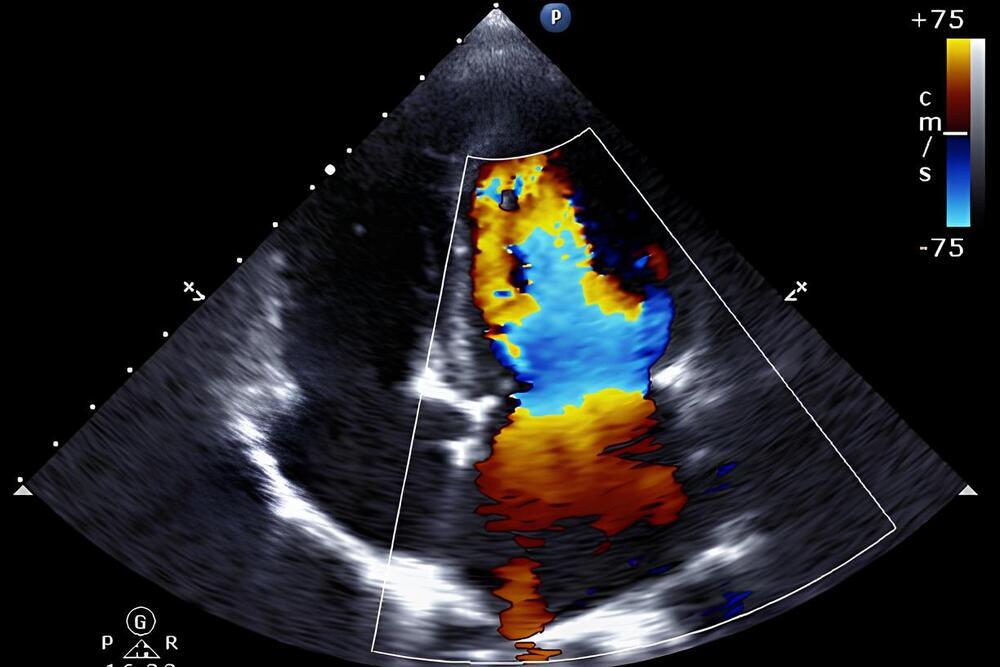 Ultrassom com Doppler | Santa Clara Diagnósticos